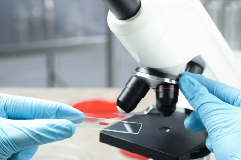 Berapa Kadar Leukosit Normal? Penting Untuk Kekebalan Tubuh!